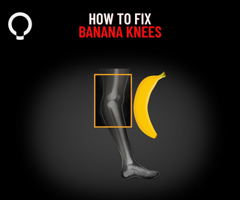 How do I fix my hyperextended knee? – Functional Patterns