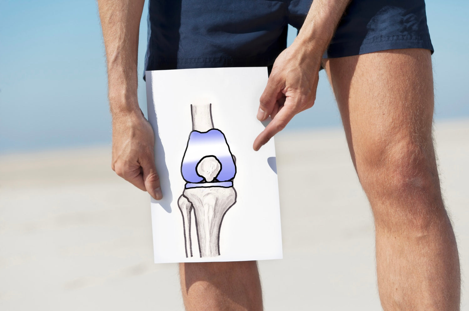 Knee Replacement Cost and Knee Replacement Alternatives to Consider ...